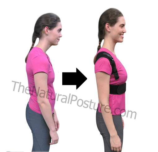 Magnetic Posture Corrector Align Your Spine with Ease - The Natural Posture